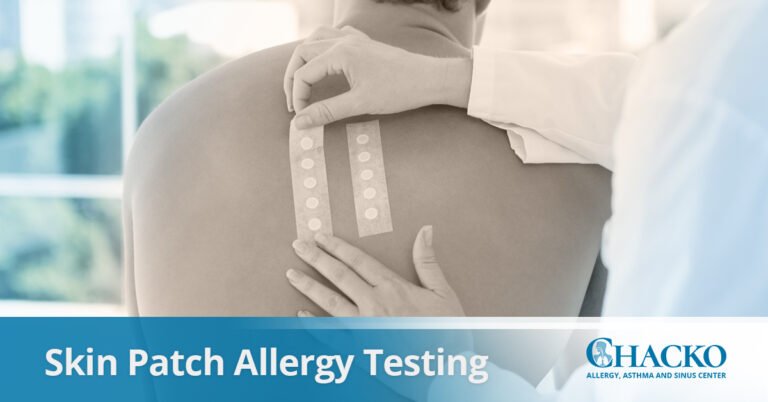 Patch Allergy Testing in Atlanta Area – Chacko Allergy